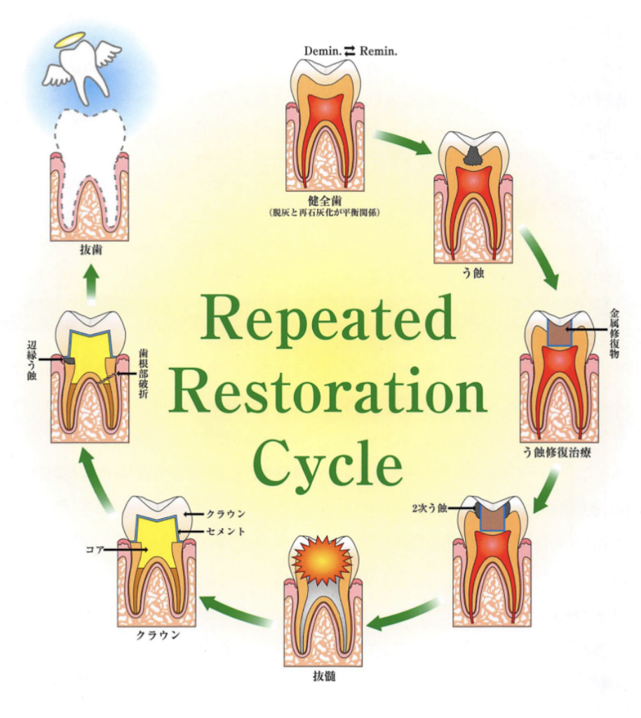 銀歯とセラミックは何が違うの？ ｜次郎丸駅エリアの歯医者｜次郎丸デンタルクリニック